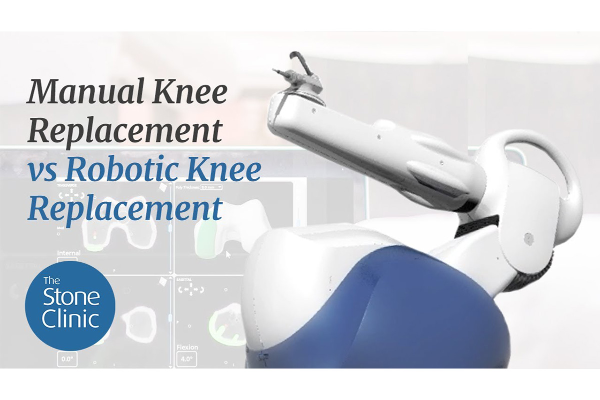 Manual Knee Replacement vs Robotic Knee Replacement (Video Blog)